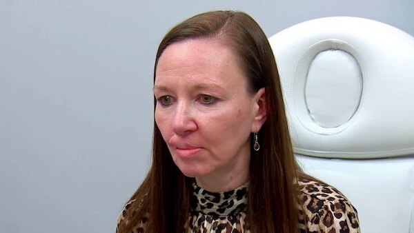 Botched Season 7 Episode 11