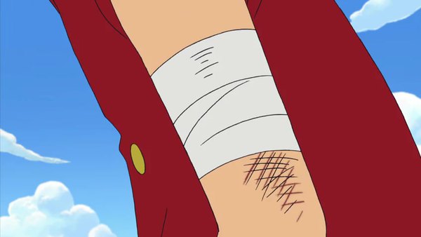 One Piece Episode 237 info and links where to watch