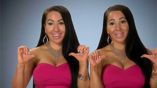 Botched Season 3 Episode 7