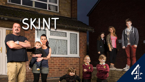 SKINT Season 2 Episode 2